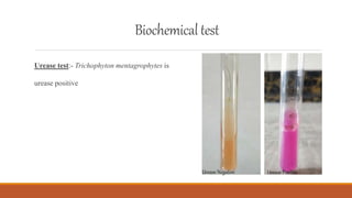 Dermatophytes | PPTX