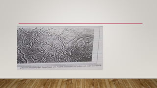 Dermatophytes , morphology, lifecycle and lab diagnosis | PPT