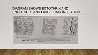 Dermatophytes , morphology, lifecycle and lab diagnosis | PPT