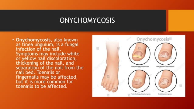 Dermatophytes .pptx | Skin and Dermatology | Diseases and Conditions