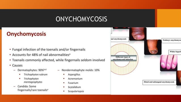 Dermatophytes .pptx | Skin and Dermatology | Diseases and Conditions