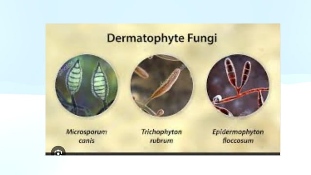 Dermatophytes-Microsporum,Epidermophyton and Trichophyton.pptx