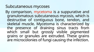 Dermatophytes-Microsporum,Epidermophyton and Trichophyton.pptx
