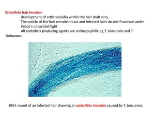 Varous Fungal agents causing dermatitis in human and animals. | PPTX