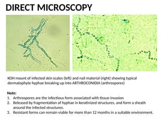 Varous Fungal agents causing dermatitis in human and animals. | PPTX
