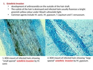 Varous Fungal agents causing dermatitis in human and animals. | PPTX