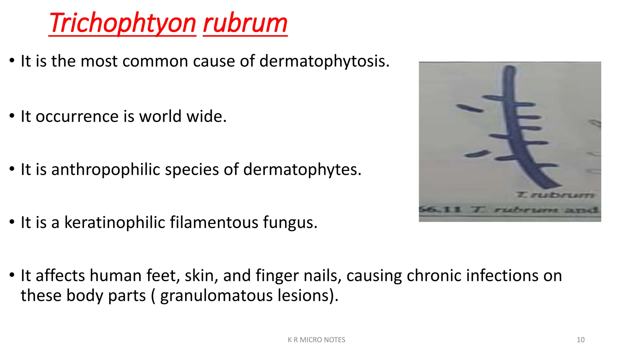 DERMATOPHYTES SUPERFICIAL MYCOSES K R.pptx | Foot Health | Diseases and ...