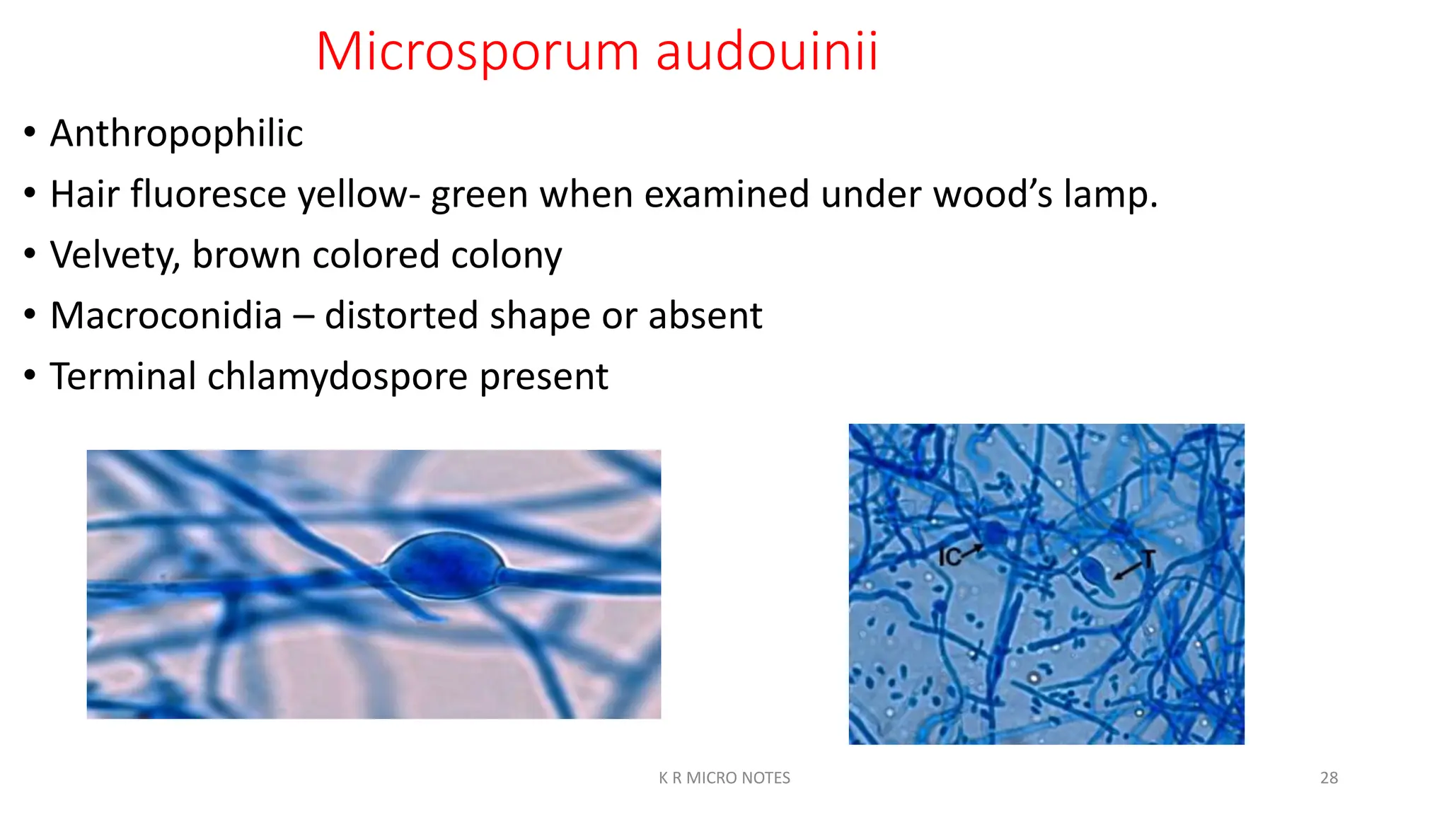 DERMATOPHYTES SUPERFICIAL MYCOSES K R.pptx
