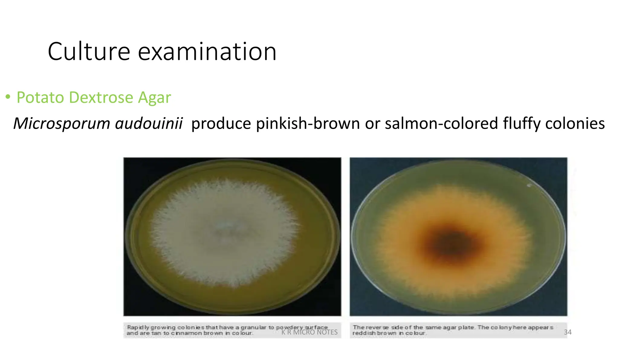 DERMATOPHYTES SUPERFICIAL MYCOSES K R.pptx