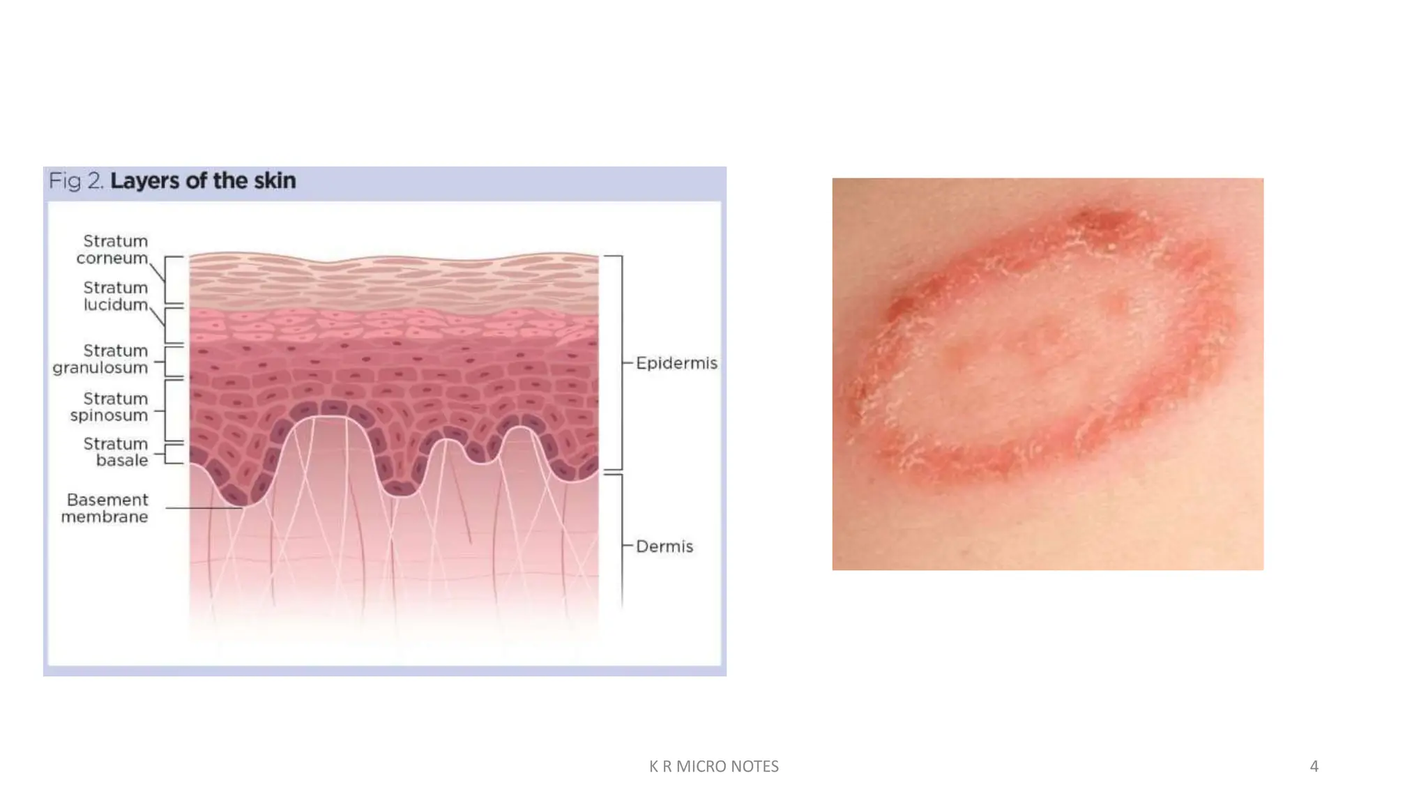 DERMATOPHYTES SUPERFICIAL MYCOSES K R.pptx