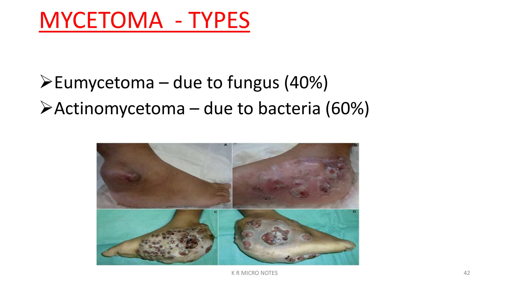 DERMATOPHYTES SUPERFICIAL MYCOSES K R.pptx