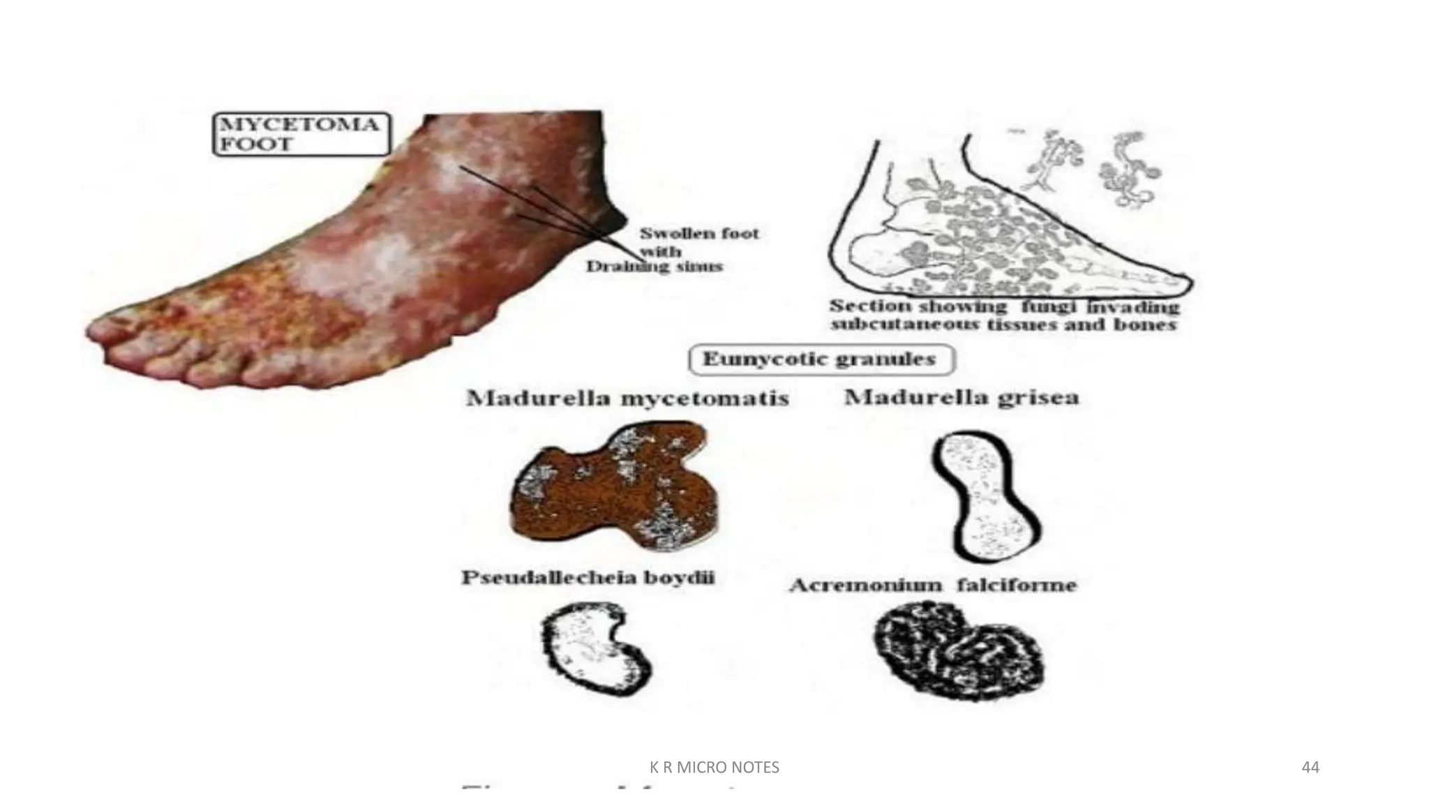 DERMATOPHYTES SUPERFICIAL MYCOSES K R.pptx