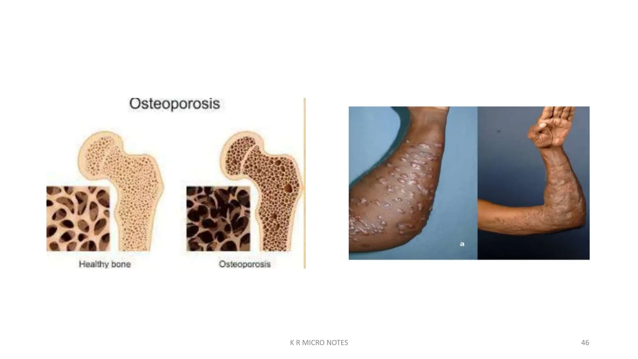 DERMATOPHYTES SUPERFICIAL MYCOSES K R.pptx