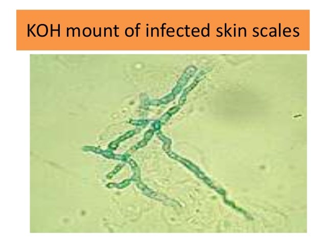 Dermatophytes undergraduates