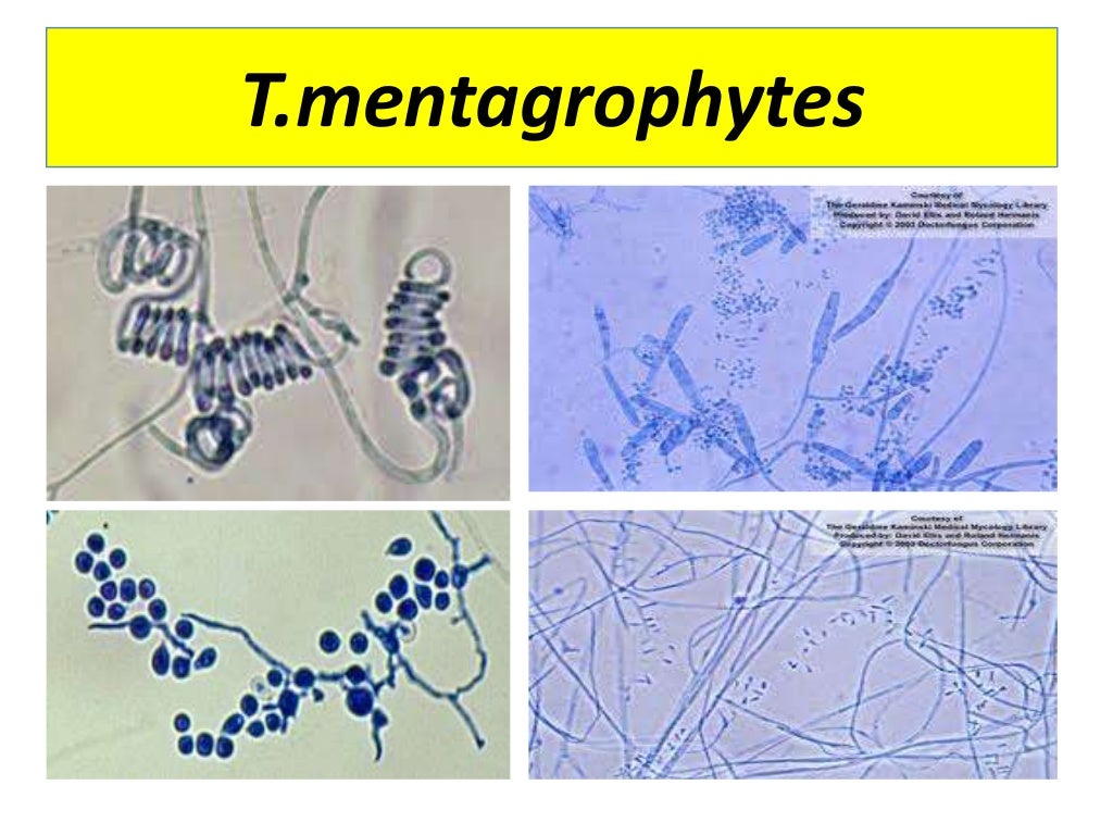 Dermatophytes undergraduates