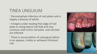 Dermato phytoses | PPT