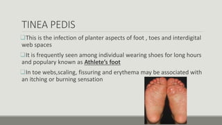 Dermato phytoses | PPT
