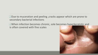 Dermato phytoses | PPTX