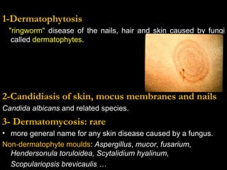 dermatophytosis .ppt