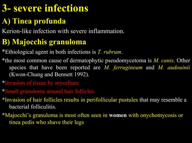 dermatophytosis .ppt