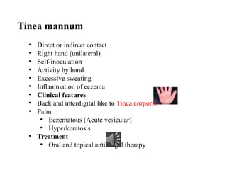 Dermatophytosis.2025.pptxsmsnsbxbssnnsssns | PPT
