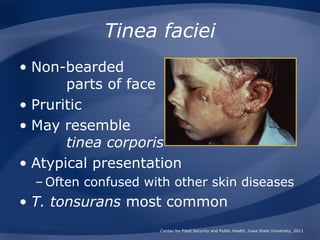 Dermatophytosis all about it lab diagnosis | PPT