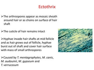 Dermatophytosis, raghu | PPTX