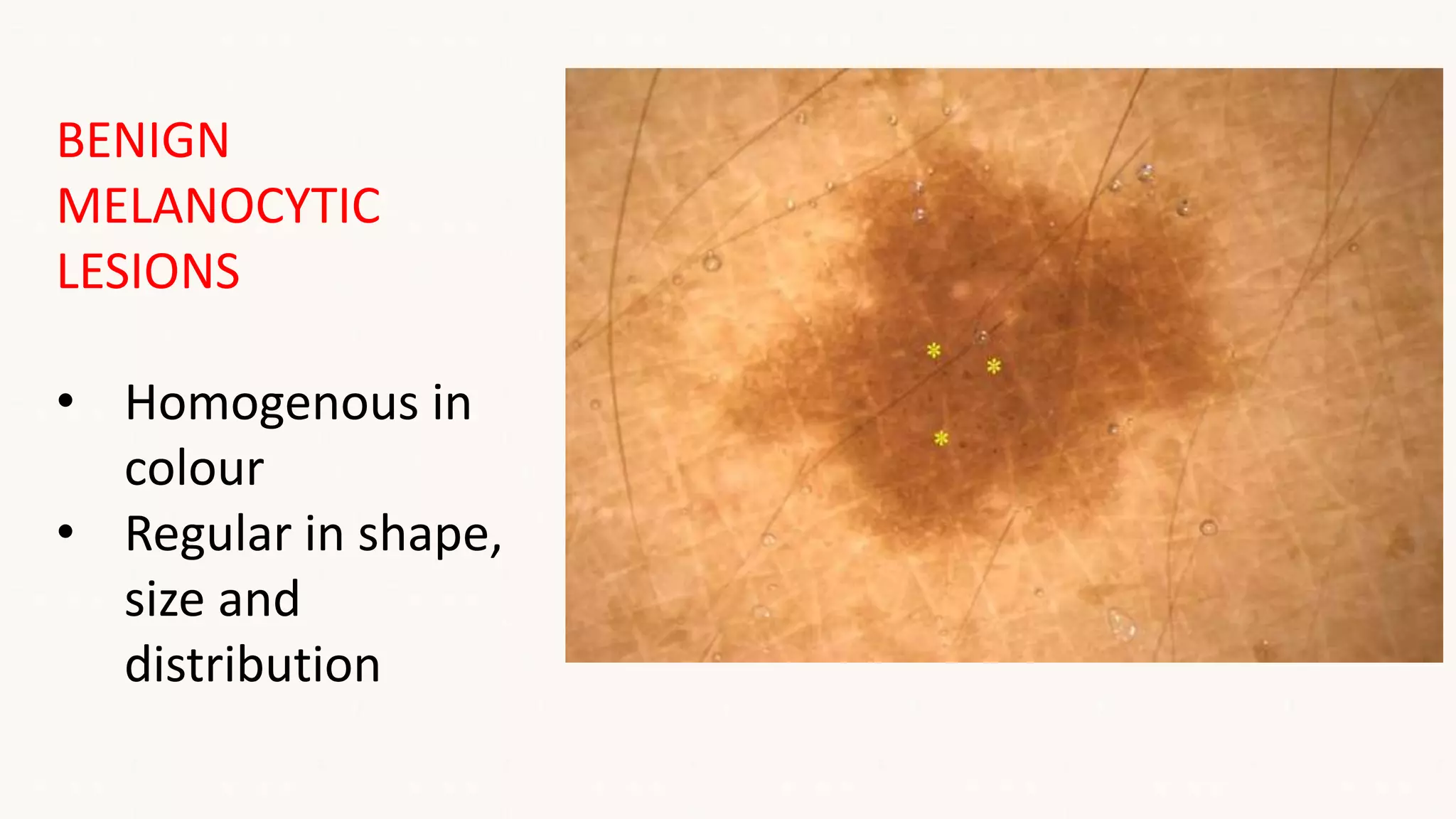 Dermatoscope and its application in dermatology | PPTX