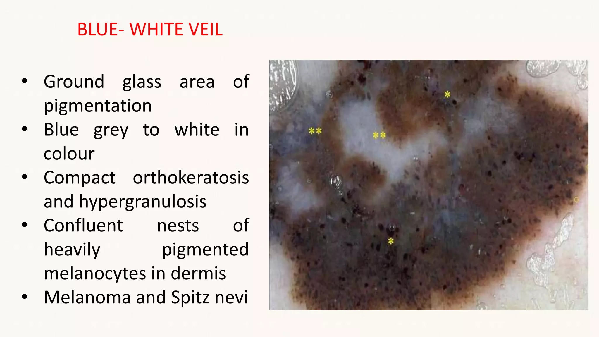 Dermatoscope and its application in dermatology | PPTX