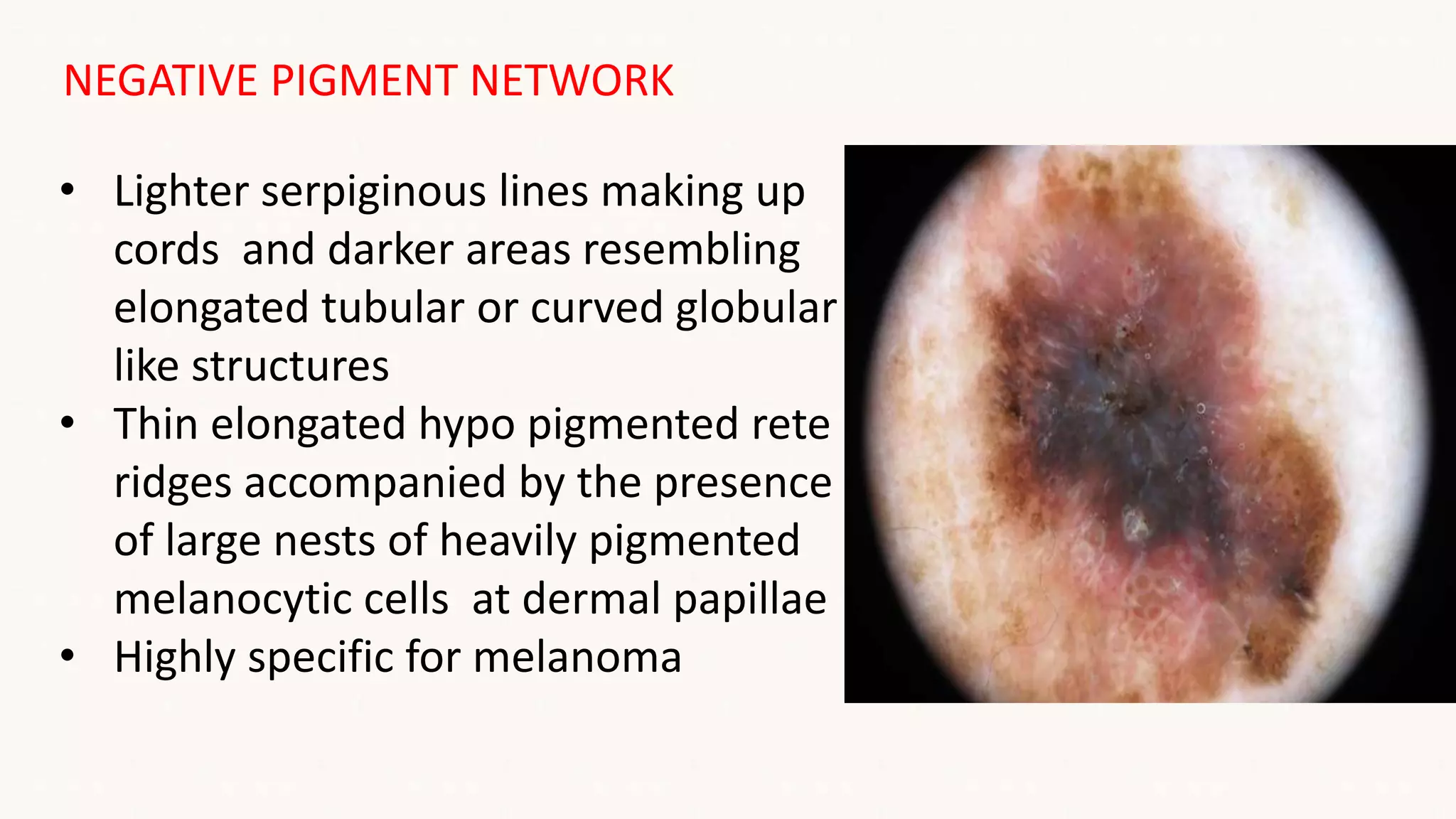Dermatoscope and its application in dermatology | PPTX