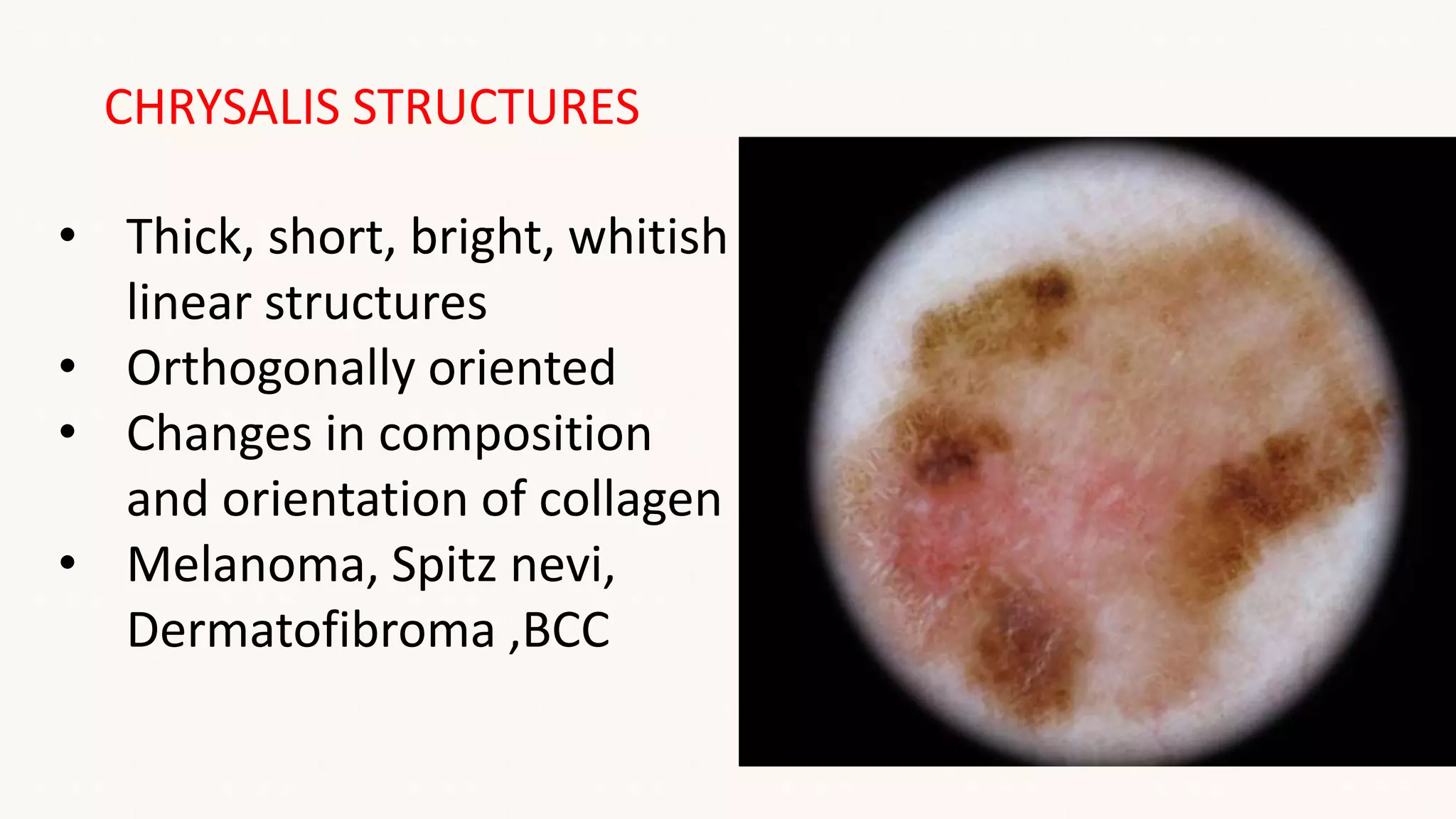 Dermatoscope and its application in dermatology | PPTX