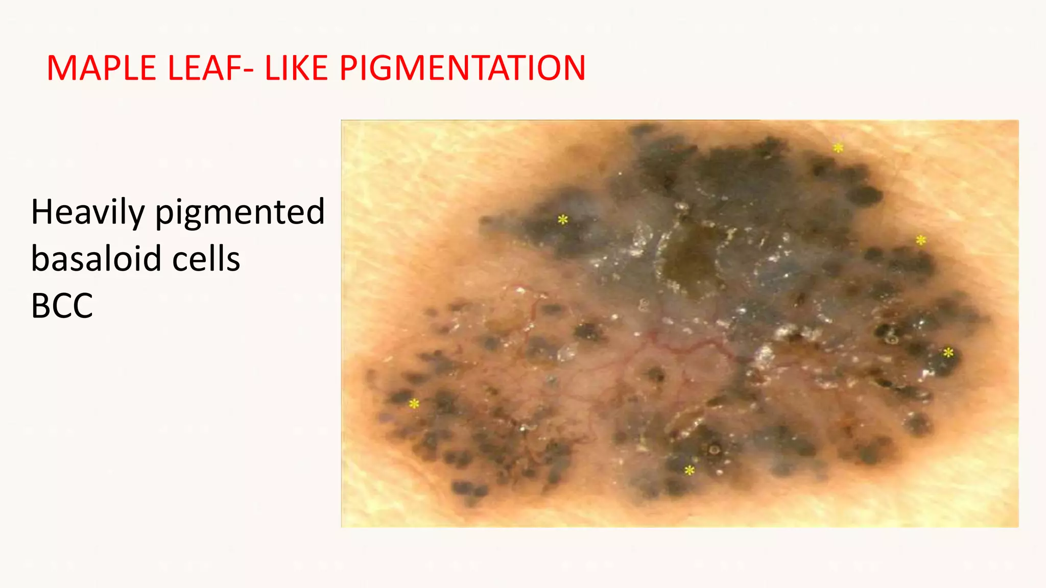 Dermatoscope and its application in dermatology | PPTX