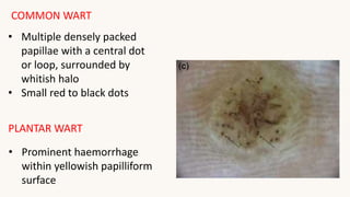 Dermatoscope and its application in dermatology | PPTX