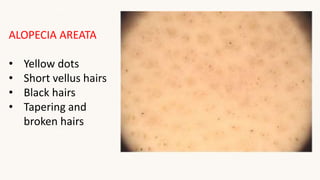Dermatoscope and its application in dermatology | PPTX