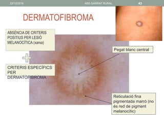 Dermatoscopia bàsica 260415 | PPTX