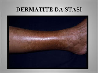 Dermatoscopia e Osservazione Epidermide | PPT
