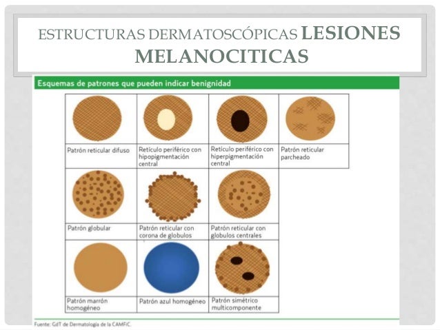 Dermatoscopia En Atención Primaria parte 2