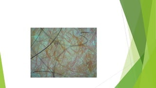 Video Dermatoscopio firefly (spanish) | PPTX