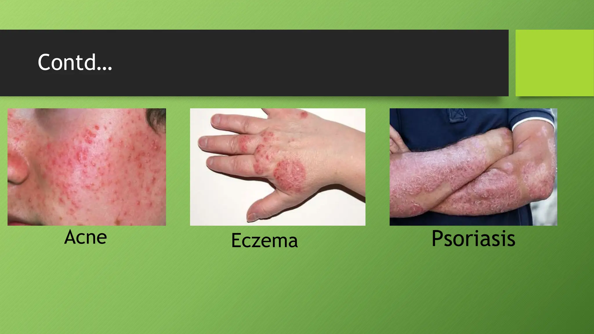 NOTE ON DERMATOSES (INTEGUMENTARY SYSTEM DISORDER) | PPTX