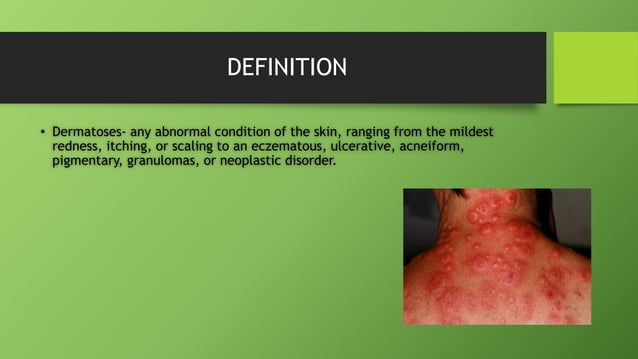 NOTE ON DERMATOSES (INTEGUMENTARY SYSTEM DISORDER) | PPTX