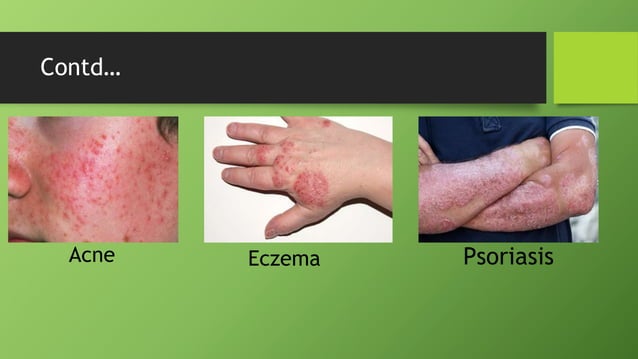 NOTE ON DERMATOSES (INTEGUMENTARY SYSTEM DISORDER) | PPTX