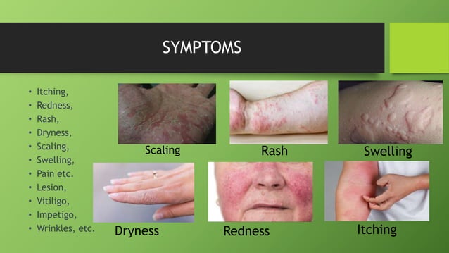 NOTE ON DERMATOSES (INTEGUMENTARY SYSTEM DISORDER) | PPTX