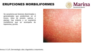 DERMATOSIS ALERGICA Y MEDICAMENTOSA DERMATOLOGIA | PPTX