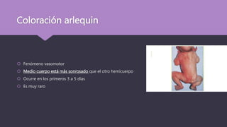 Dermatosis del Recién Nacido.pptx