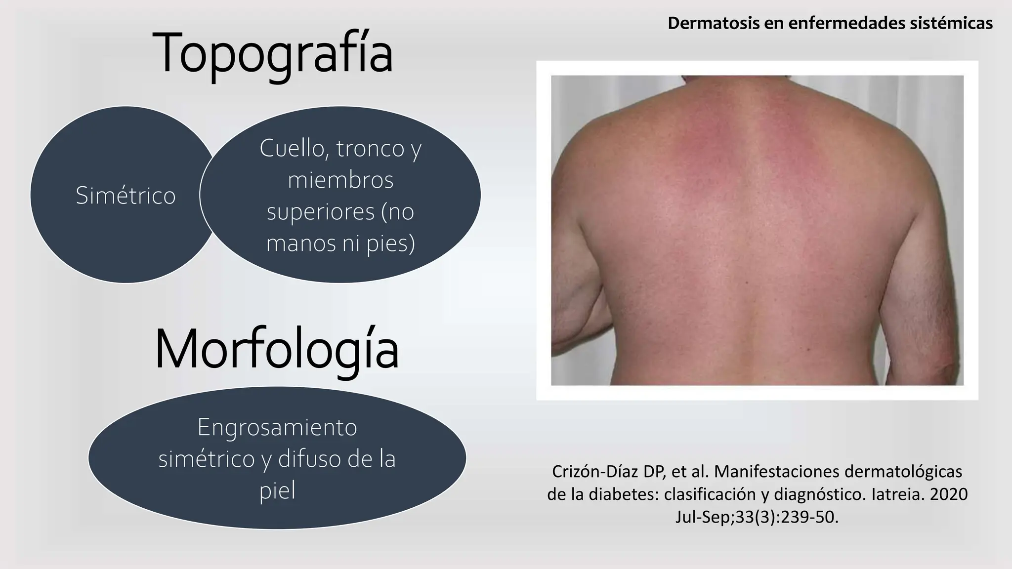 Dermatosis en Enfermedades Sistémicas (Diabetes Mellitus, Enfermedad ...