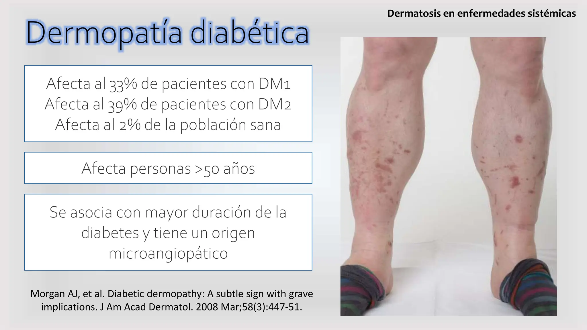 Dermatosis en Enfermedades Sistémicas (Diabetes Mellitus, Enfermedad ...