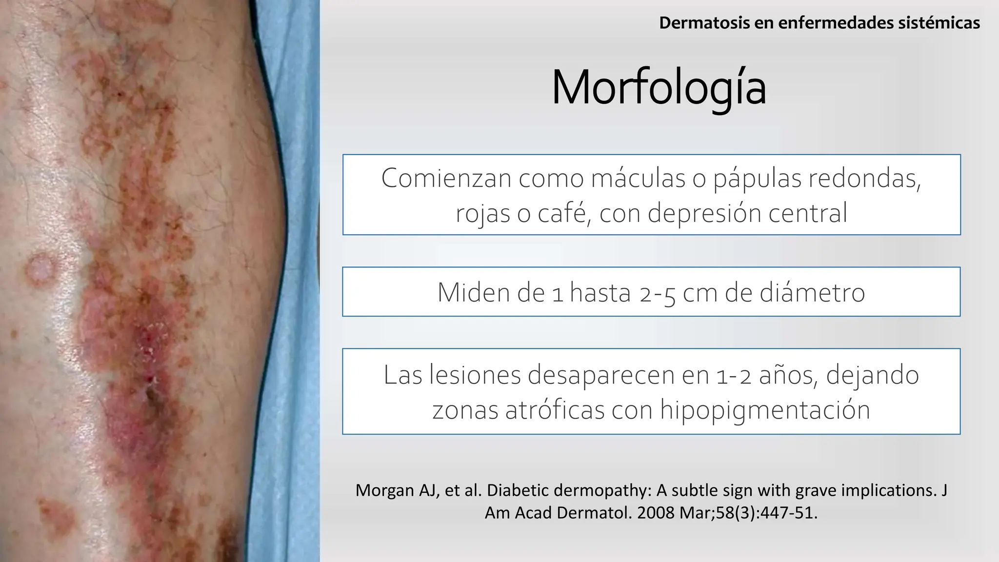 Dermatosis en Enfermedades Sistémicas (Diabetes Mellitus, Enfermedad ...