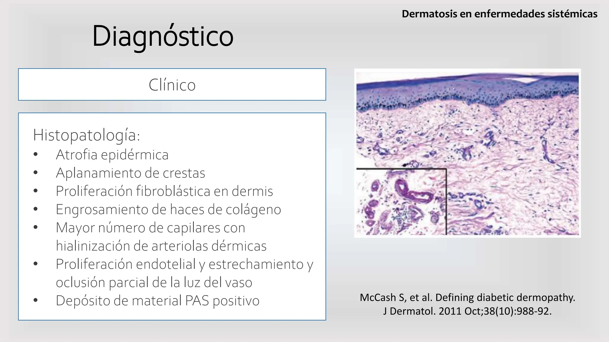 Dermatosis en Enfermedades Sistémicas (Diabetes Mellitus, Enfermedad ...