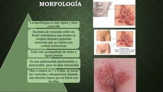 Dermatosis virales | PPTX