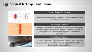 Dermatotraction- Novel surgical wound closures methods - dr. ali barat.pptx
